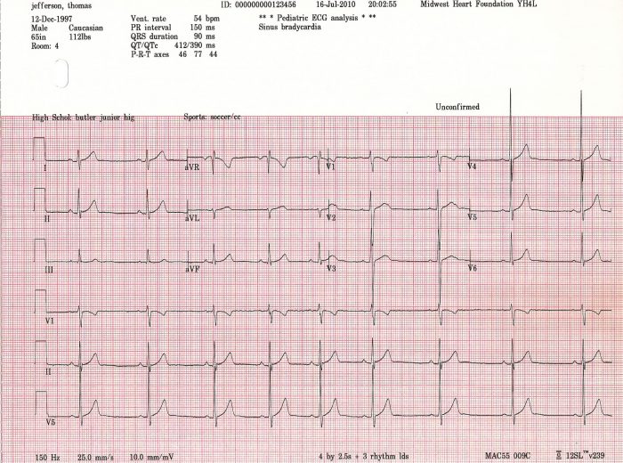 Young Hearts for Life - Heart Screening Program : Young Hearts For Life ...